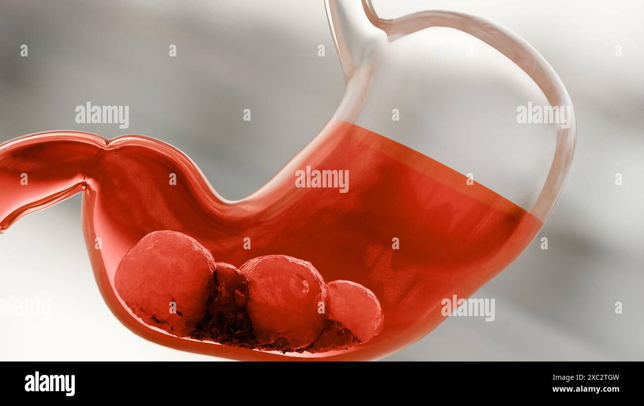 Menschlicher Magen Anatomie Verdauung, Ösophagus Abdomen Magen mit ...