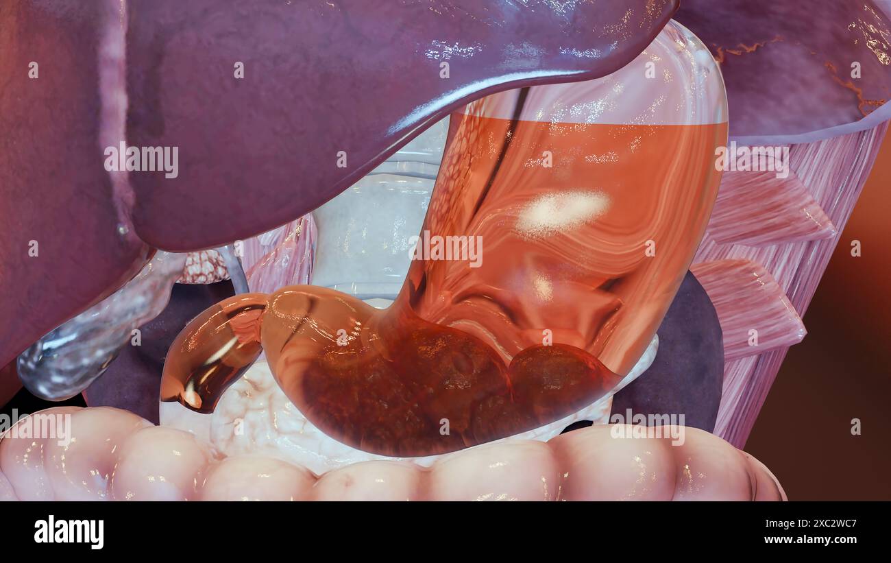 Menschlicher Magen Anatomie Verdauung, Ösophagus Abdomen Magen mit ...