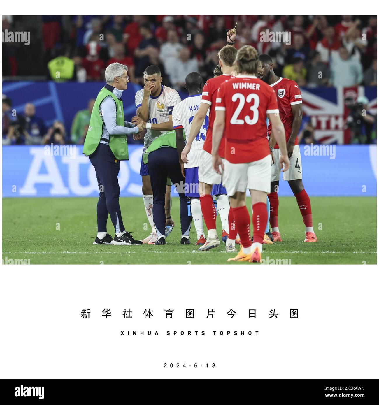 (240618) -- PEKING, 18. Juni 2024 (Xinhua) -- Kylian Mbappe (2. L) aus ...