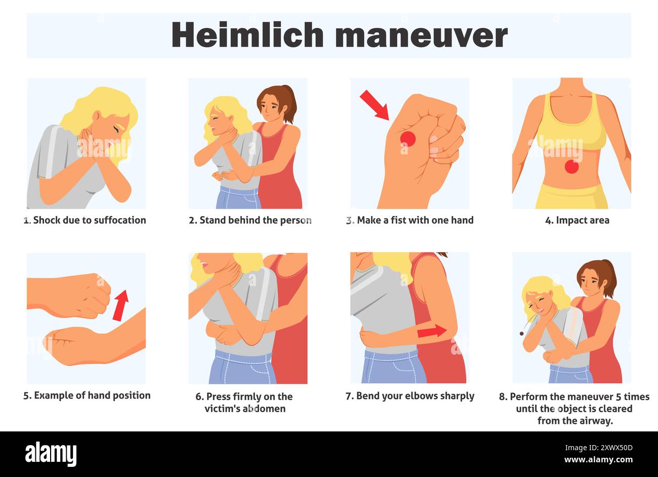 Heimlich-Manöver-Infografik-Poster mit ersten-Hilfe-Schritten Stock-Vektorgrafik - Alamy