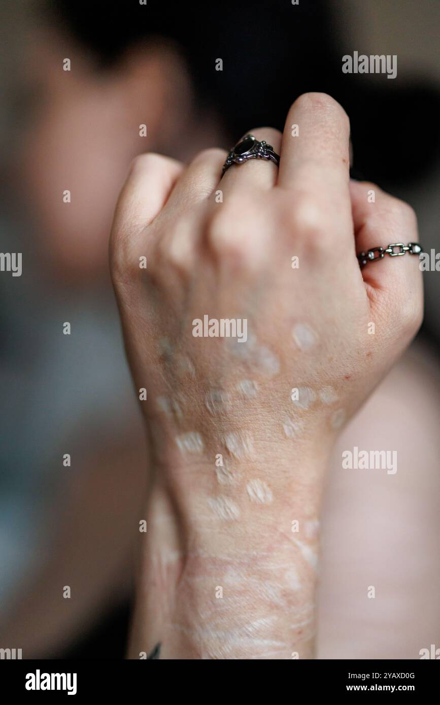 Nürnberg, Deutschland. Oktober 2024. Ein Opfer selbstverletzenden ...