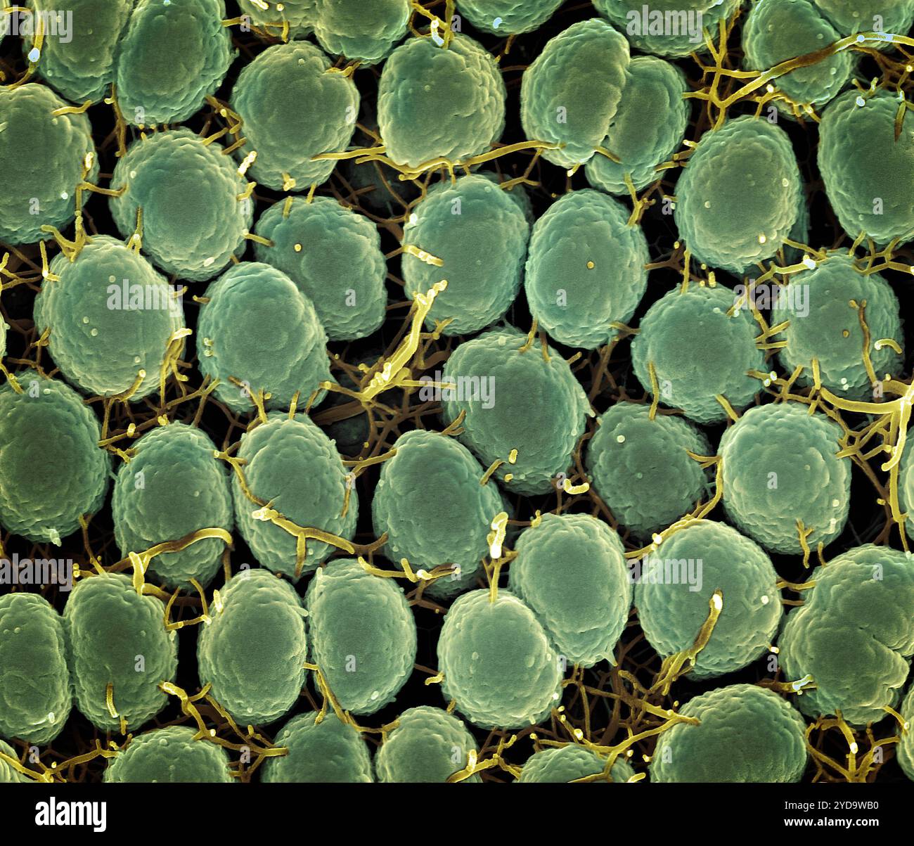 Rasterelektronenmikroskopische Darstellung von Neisseria gonorrhoeae ...