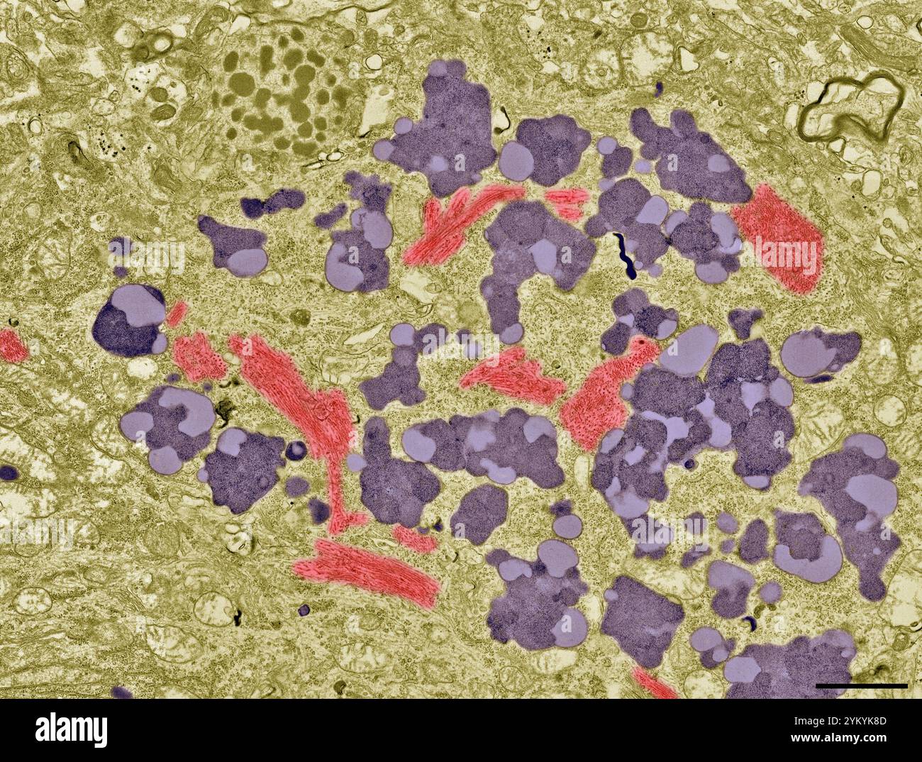 Farbige Transmissionselektronenmikrographie (TEM) eines Neurons ...