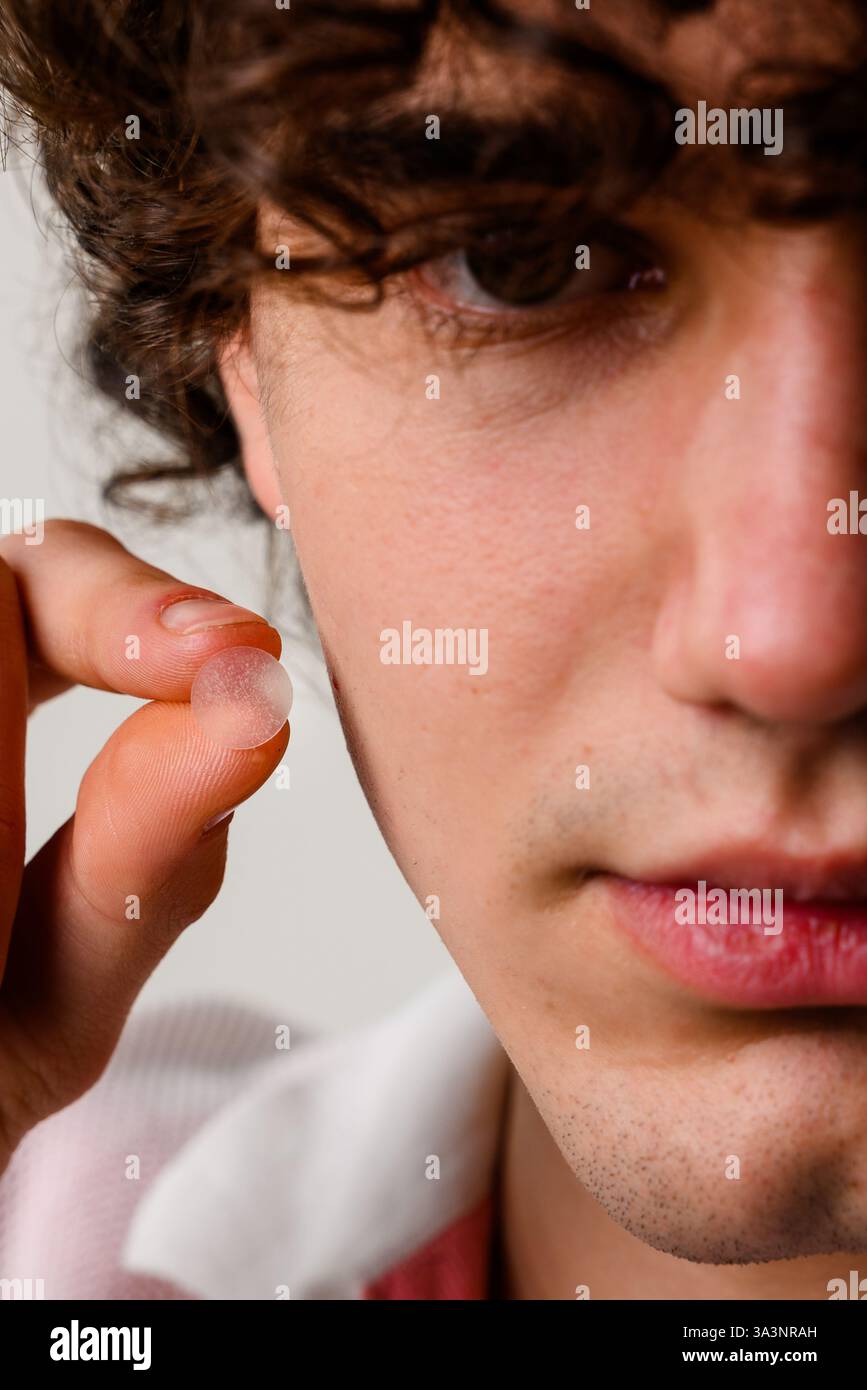 Dermatologische Aknepflaster oder Aufkleber, um überschüssige ...