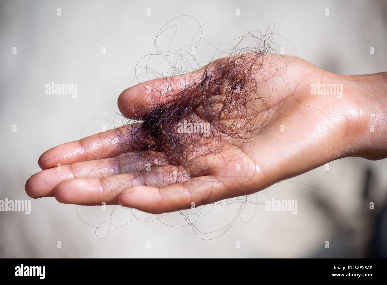 Armer schuppen -Fotos und -Bildmaterial in hoher Auflösung – Alamy