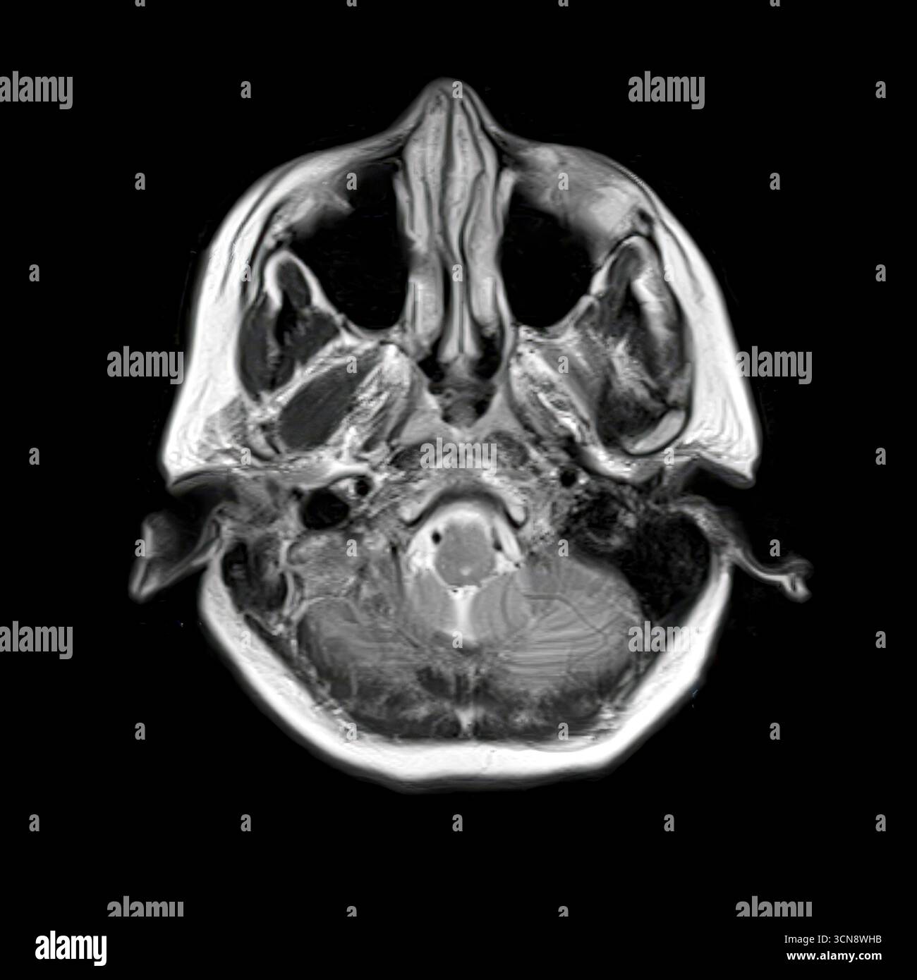 Menschliches auge und querschnitt -Fotos und -Bildmaterial in hoher ...
