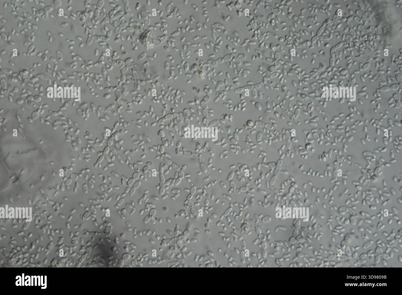 Hefe mikroskop -Fotos und -Bildmaterial in hoher Auflösung – Alamy