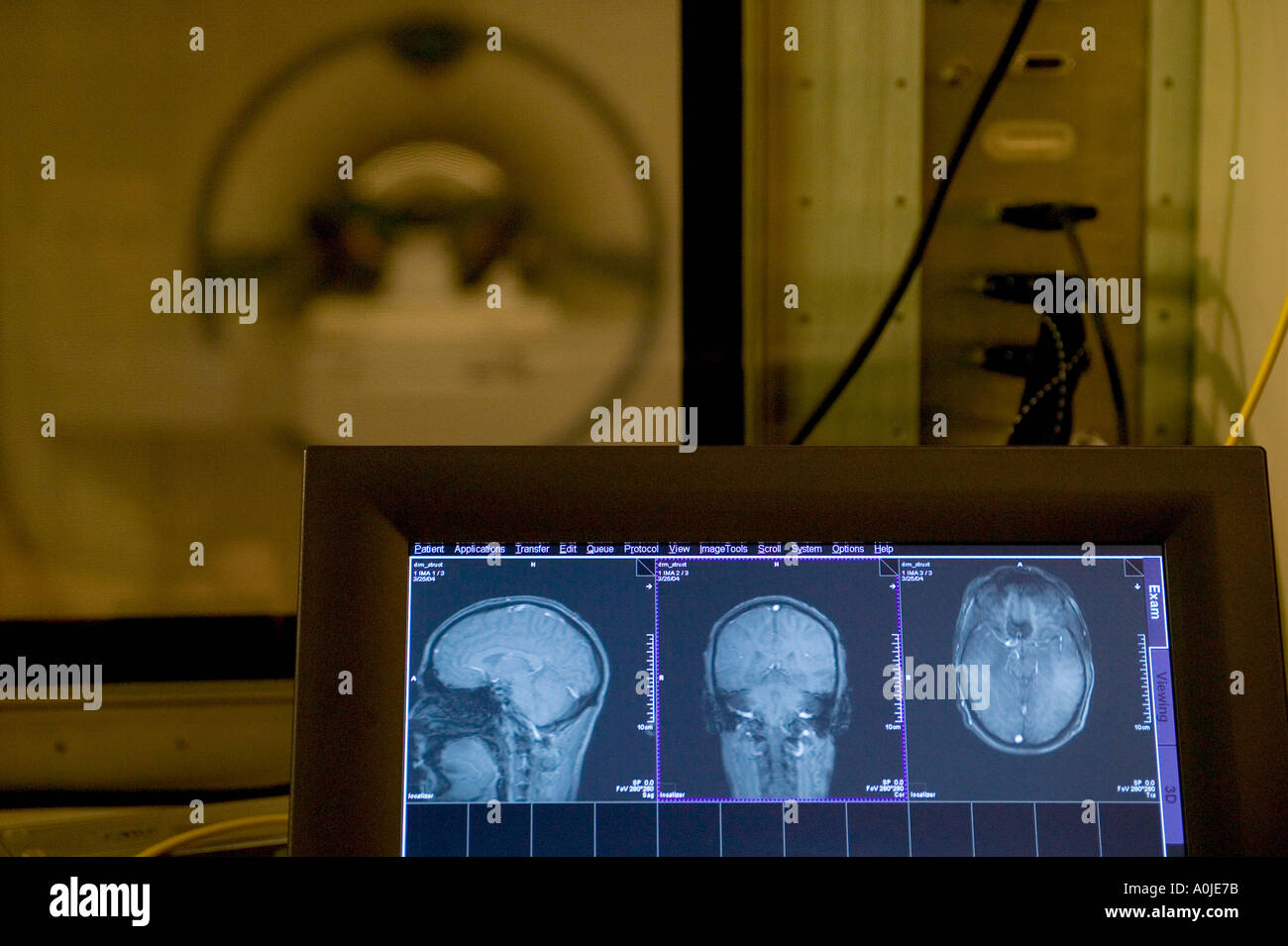 Funktionelle Mri Stockfotos und -bilder Kaufen - Alamy