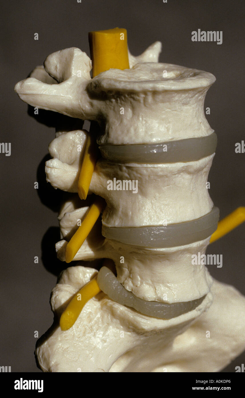 Types and Causes of Circumferential Disc Bulge