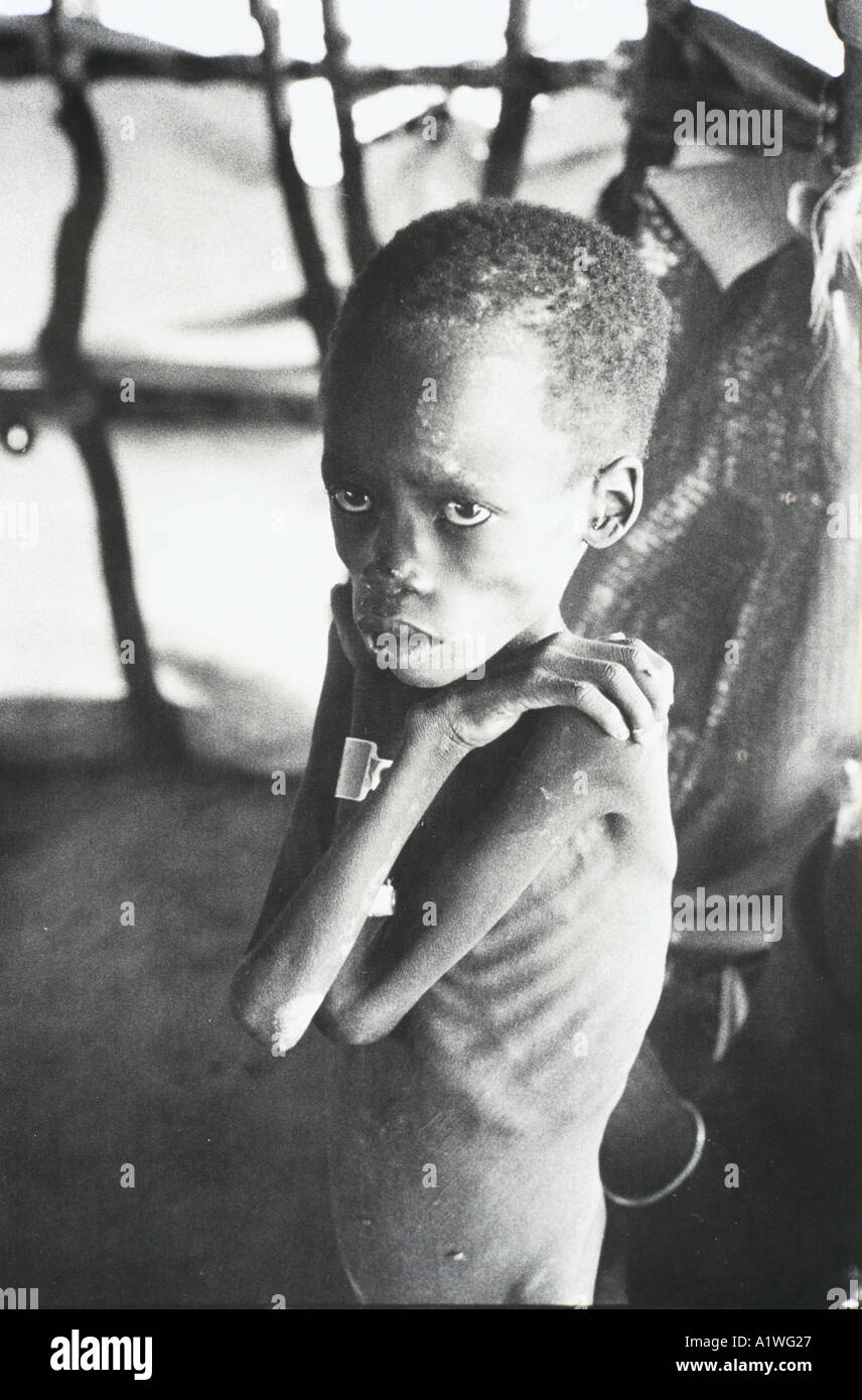 Verhungerndes kind -Fotos und -Bildmaterial in hoher Auflösung – Alamy