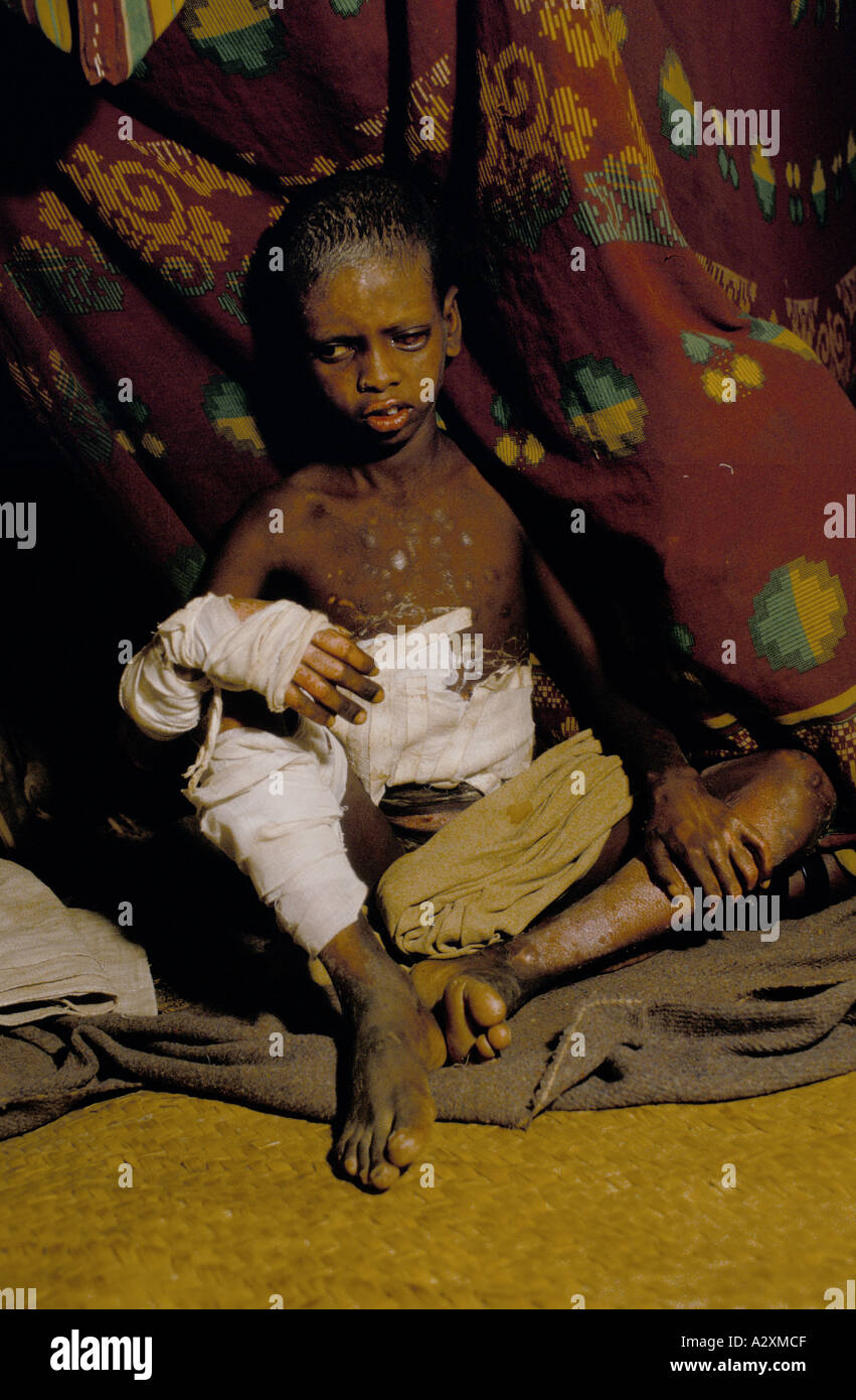 Napalm Attack Stockfotos und -bilder Kaufen - Alamy