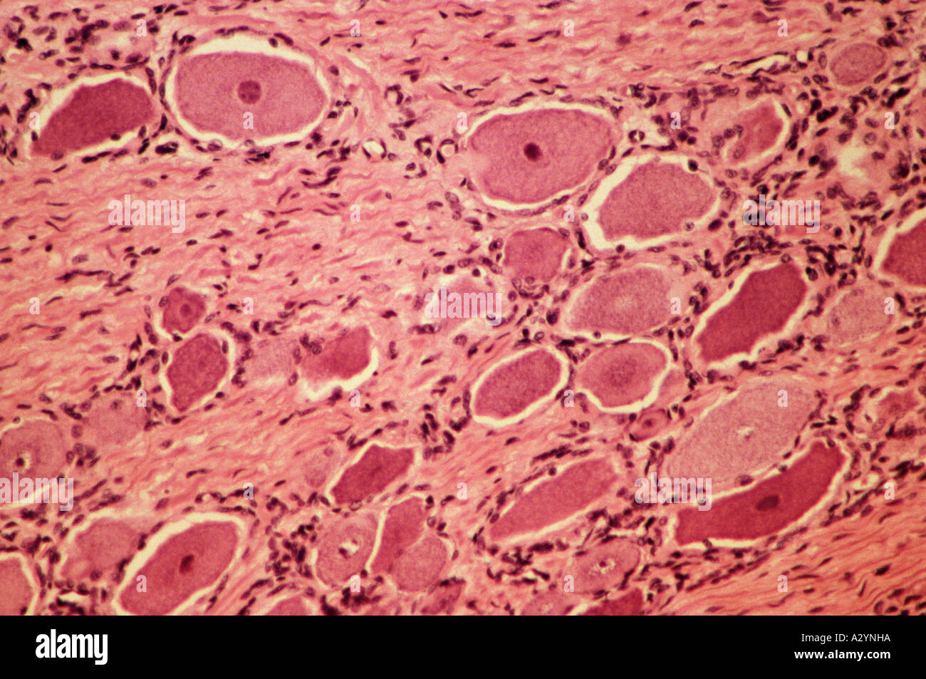 Ganglion cells -Fotos und -Bildmaterial in hoher Auflösung – Alamy
