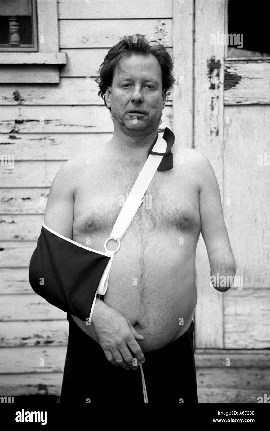 Einarmiger mann -Fotos und -Bildmaterial in hoher Auflösung – Alamy