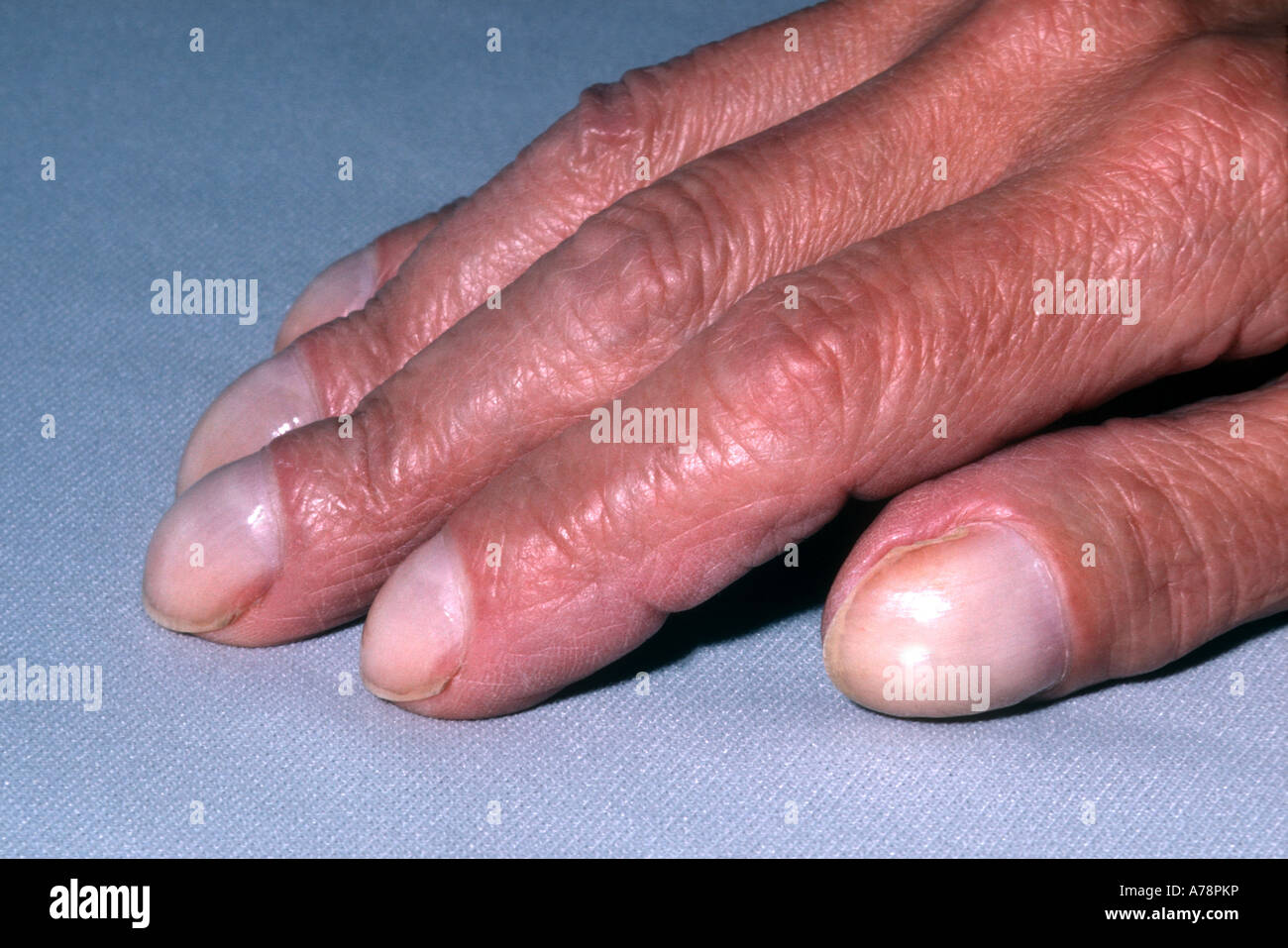 Marie bamberger -Fotos und -Bildmaterial in hoher Auflösung – Alamy