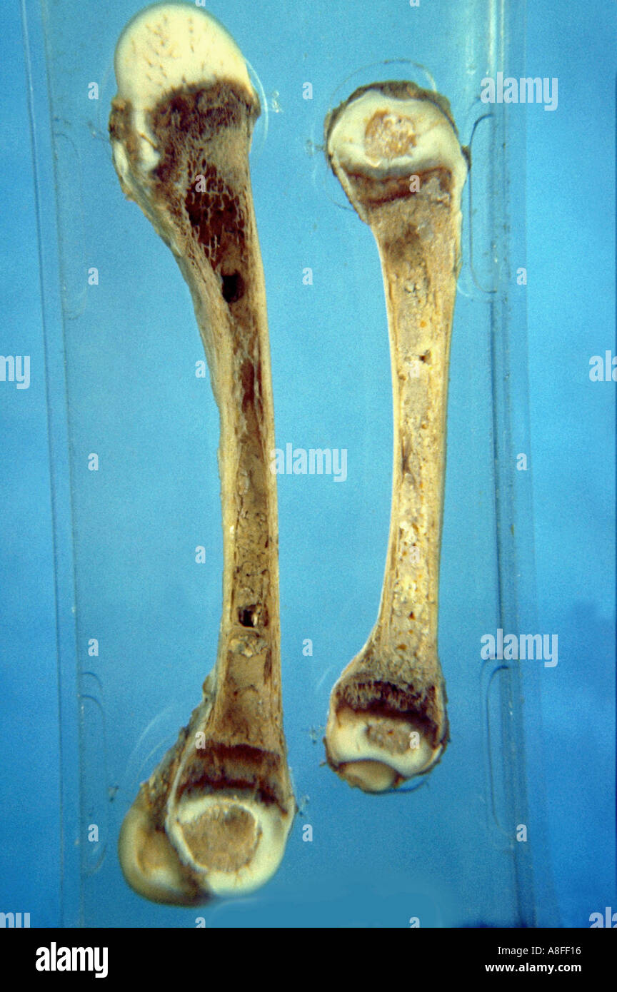 Ossifikation Des Femurs Stockfotos und -bilder Kaufen - Alamy