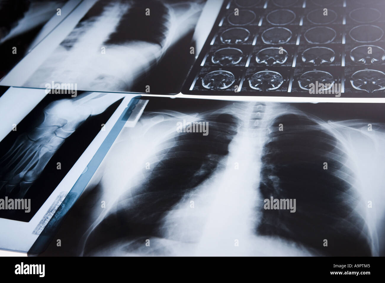 Mri scannt -Fotos und -Bildmaterial in hoher Auflösung – Alamy