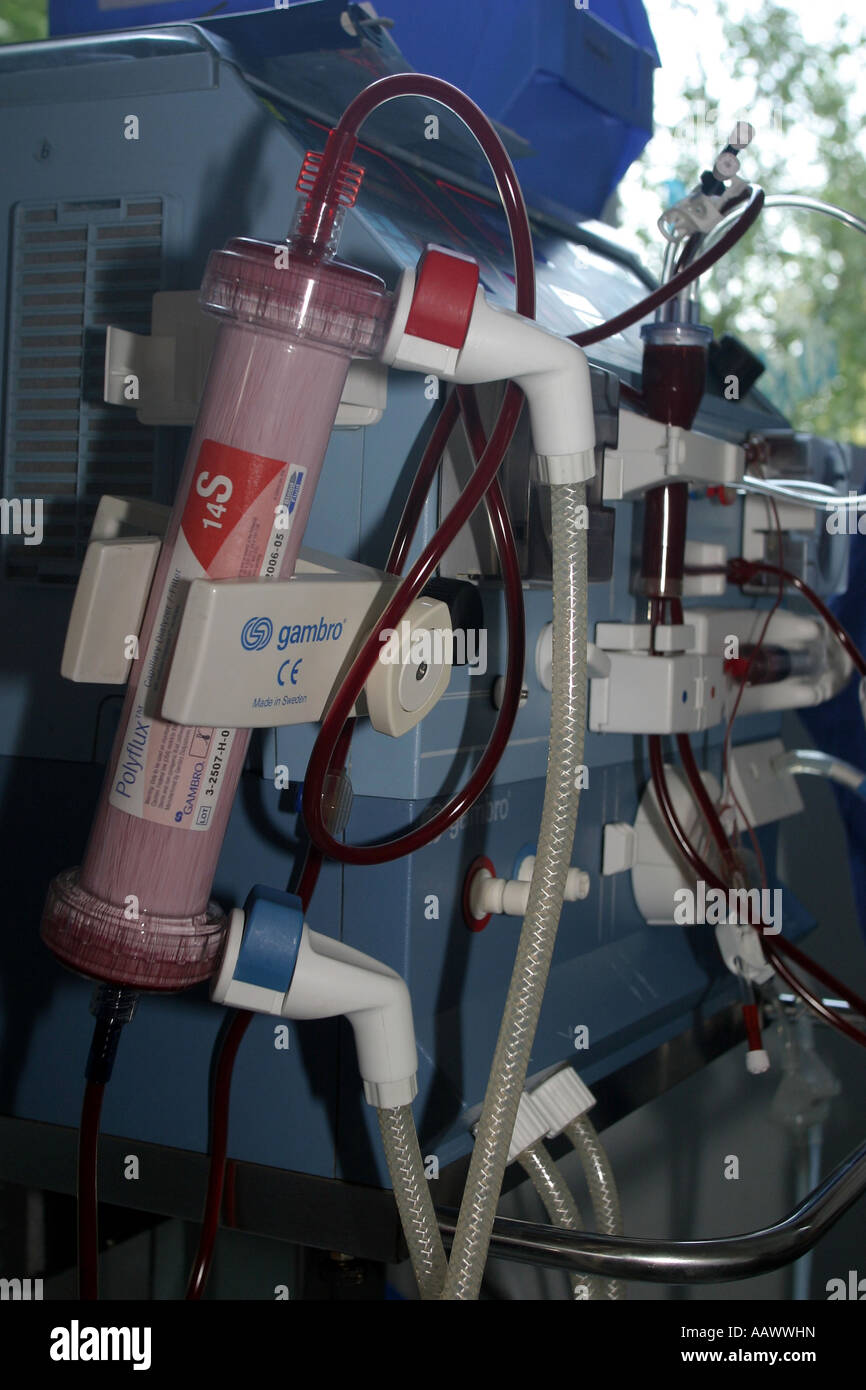 Dialyse gerät -Fotos und -Bildmaterial in hoher Auflösung – Alamy