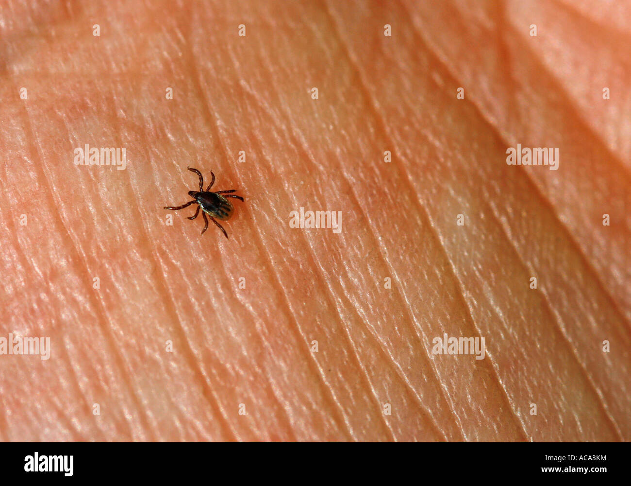Zecke Mensch Stockfotos und -bilder Kaufen - Alamy