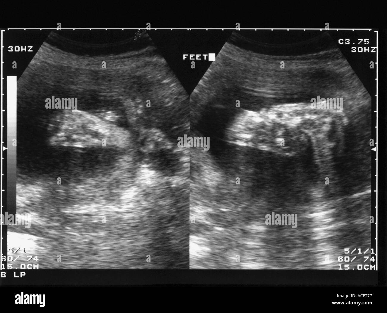 Ultraschalluntersuchung kinder -Fotos und -Bildmaterial in hoher ...