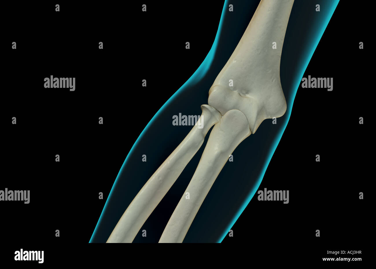 Lateraler Kondylus Stockfotos und -bilder Kaufen - Alamy