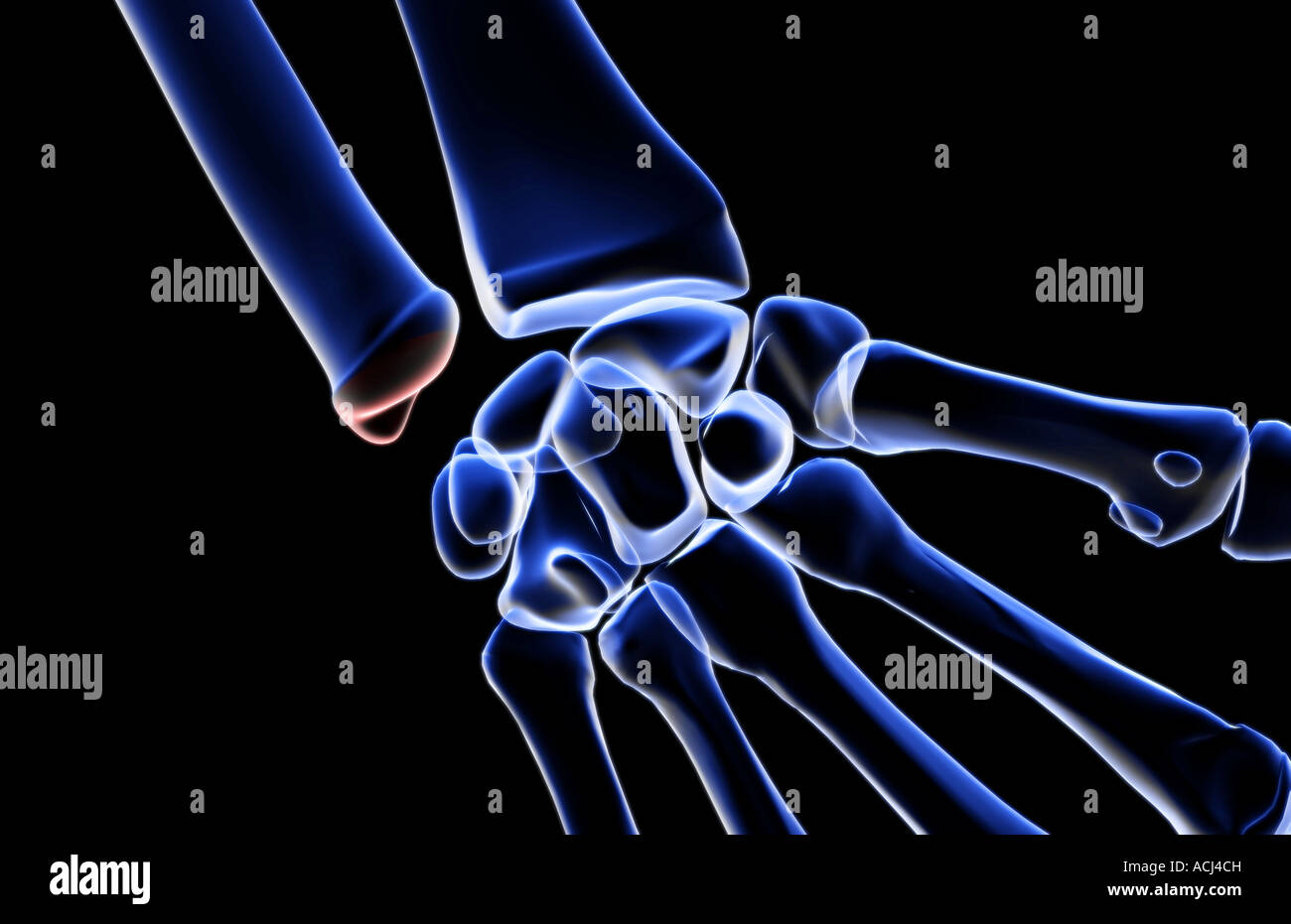 Die Knochen des Handgelenks Stockfotografie - Alamy