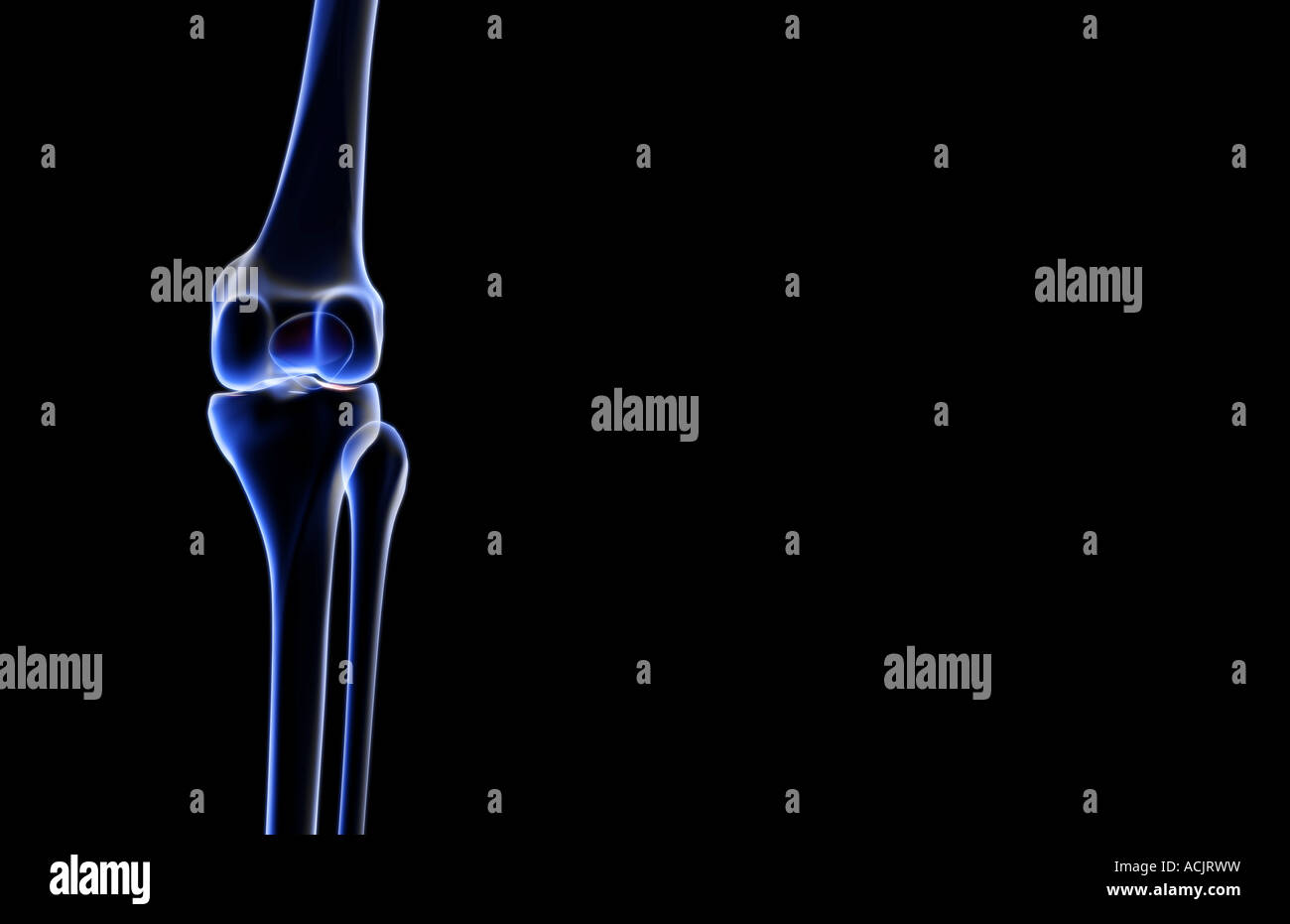 X ray knee lateral -Fotos und -Bildmaterial in hoher Auflösung – Alamy