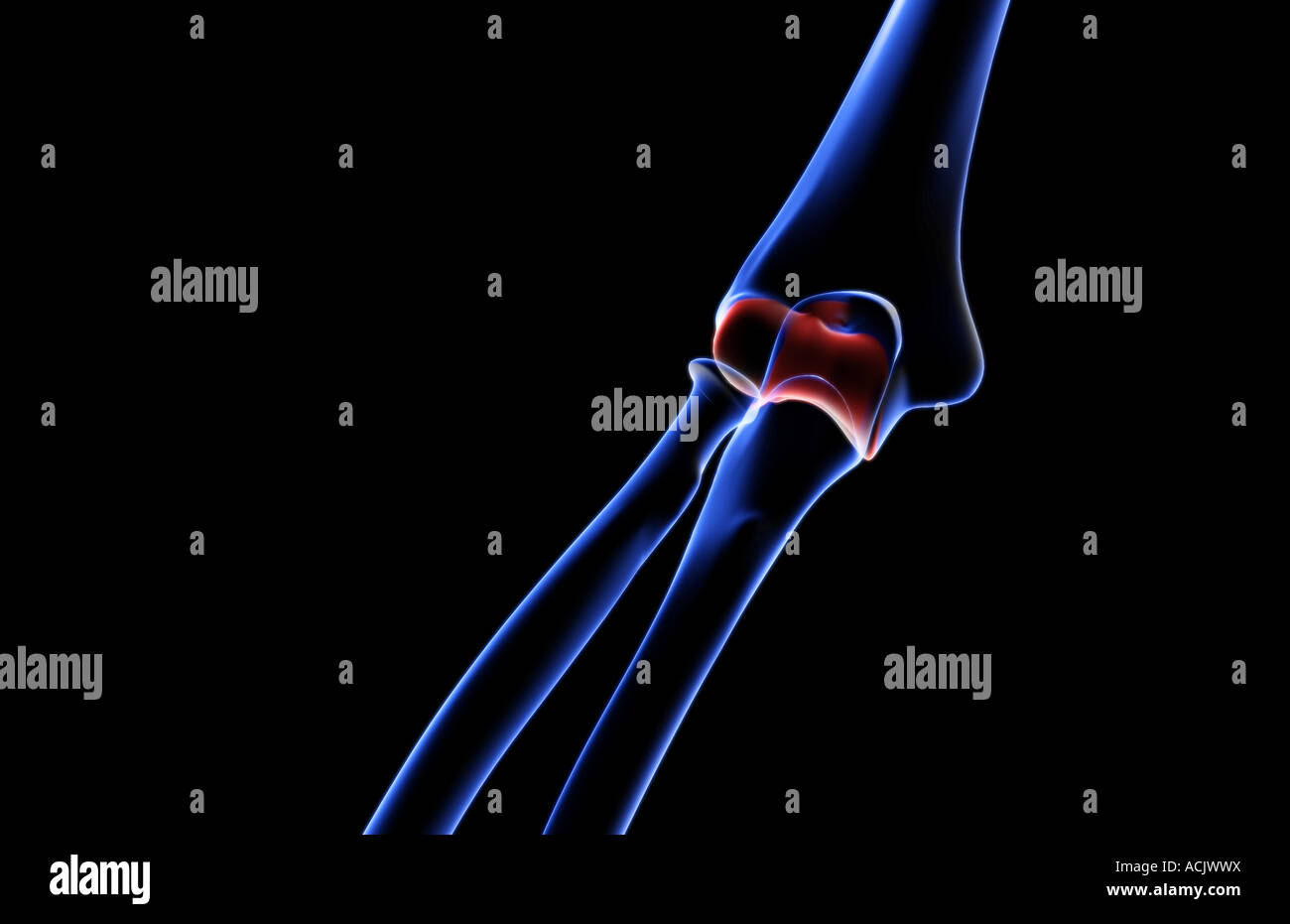 Lateraler Kondylus Stockfotos und -bilder Kaufen - Alamy