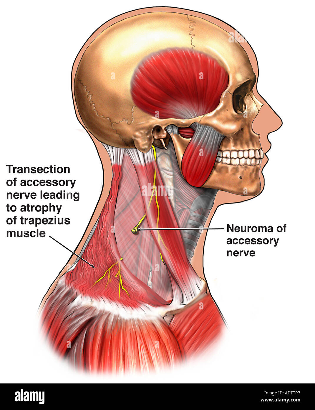 Nervus accessorius -Fotos und -Bildmaterial in hoher Auflösung – Alamy