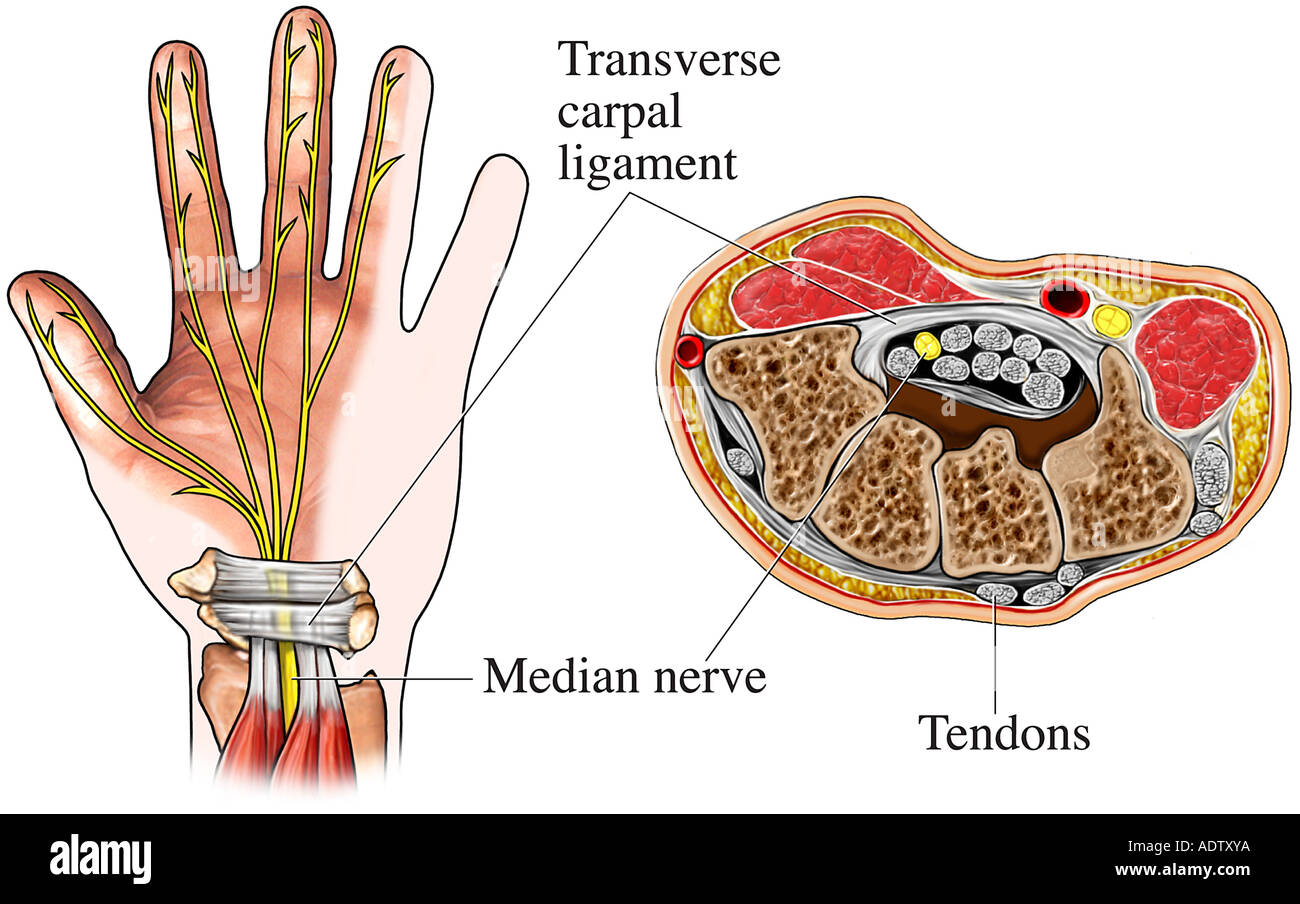 Transverse carpal ligament -Fotos und -Bildmaterial in hoher Auflösung ...
