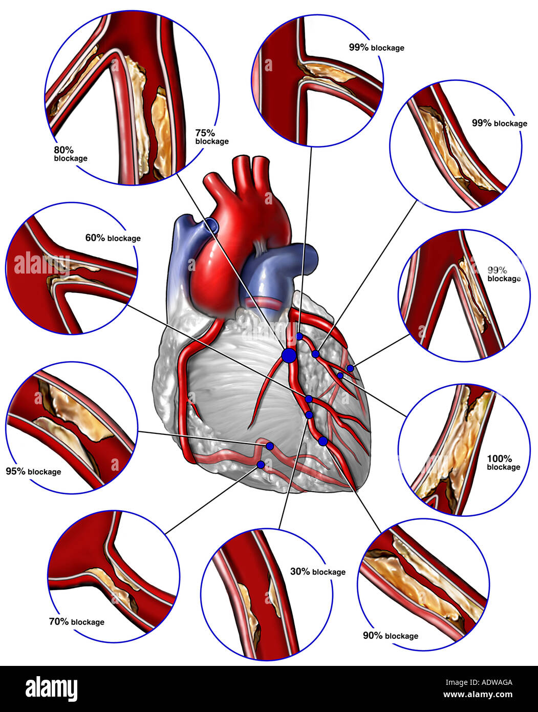 Coronary Veins Stockfotos und -bilder Kaufen - Alamy