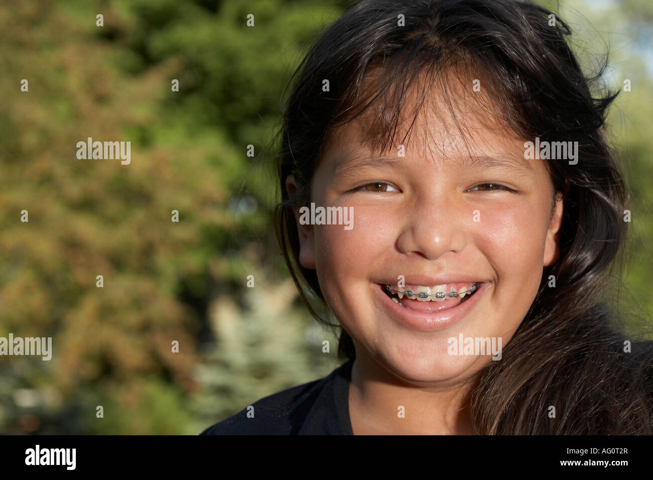 Girl preteen portrait braces smile -Fotos und -Bildmaterial in hoher ...