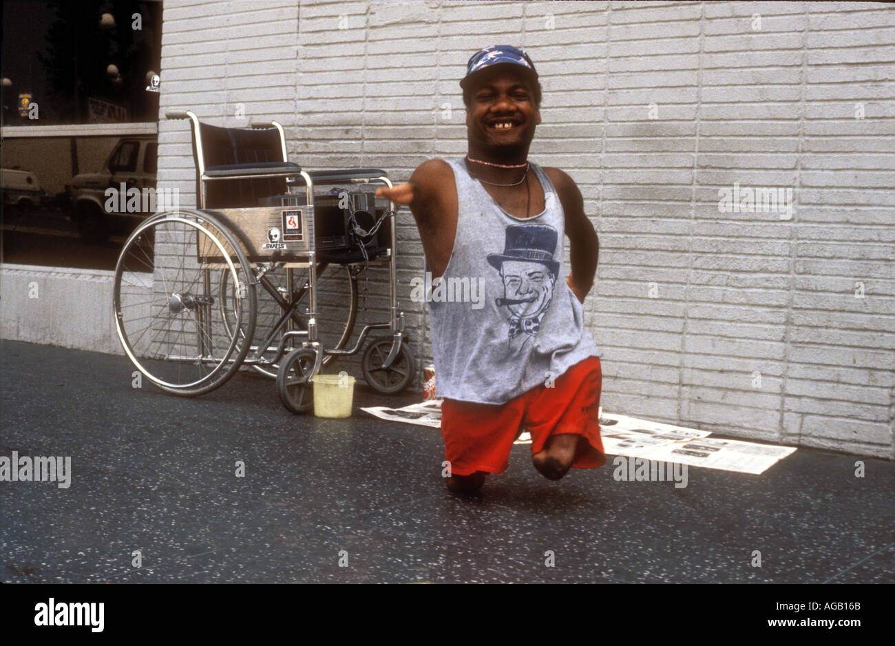 Amputee Amputation Stockfotos & Amputee Amputation Bilder - Alamy