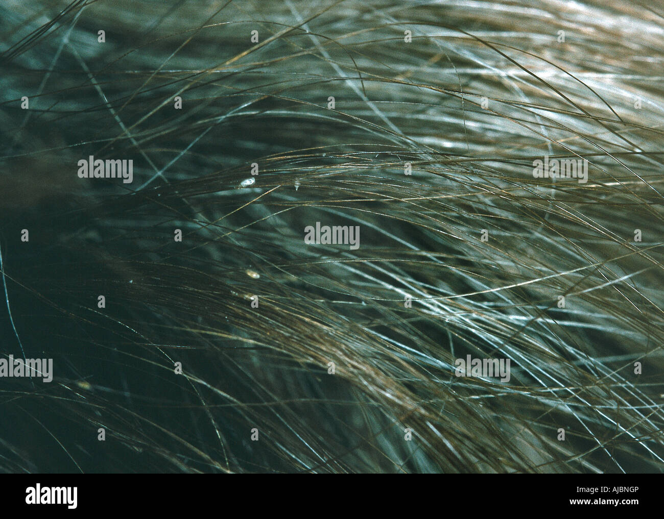 Kopfläuse in Haar Stockfoto, Bild: 14686869 - Alamy