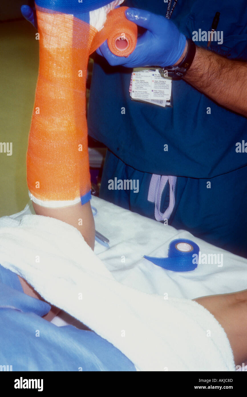 Gipsbein mädchen -Fotos und -Bildmaterial in hoher Auflösung – Alamy