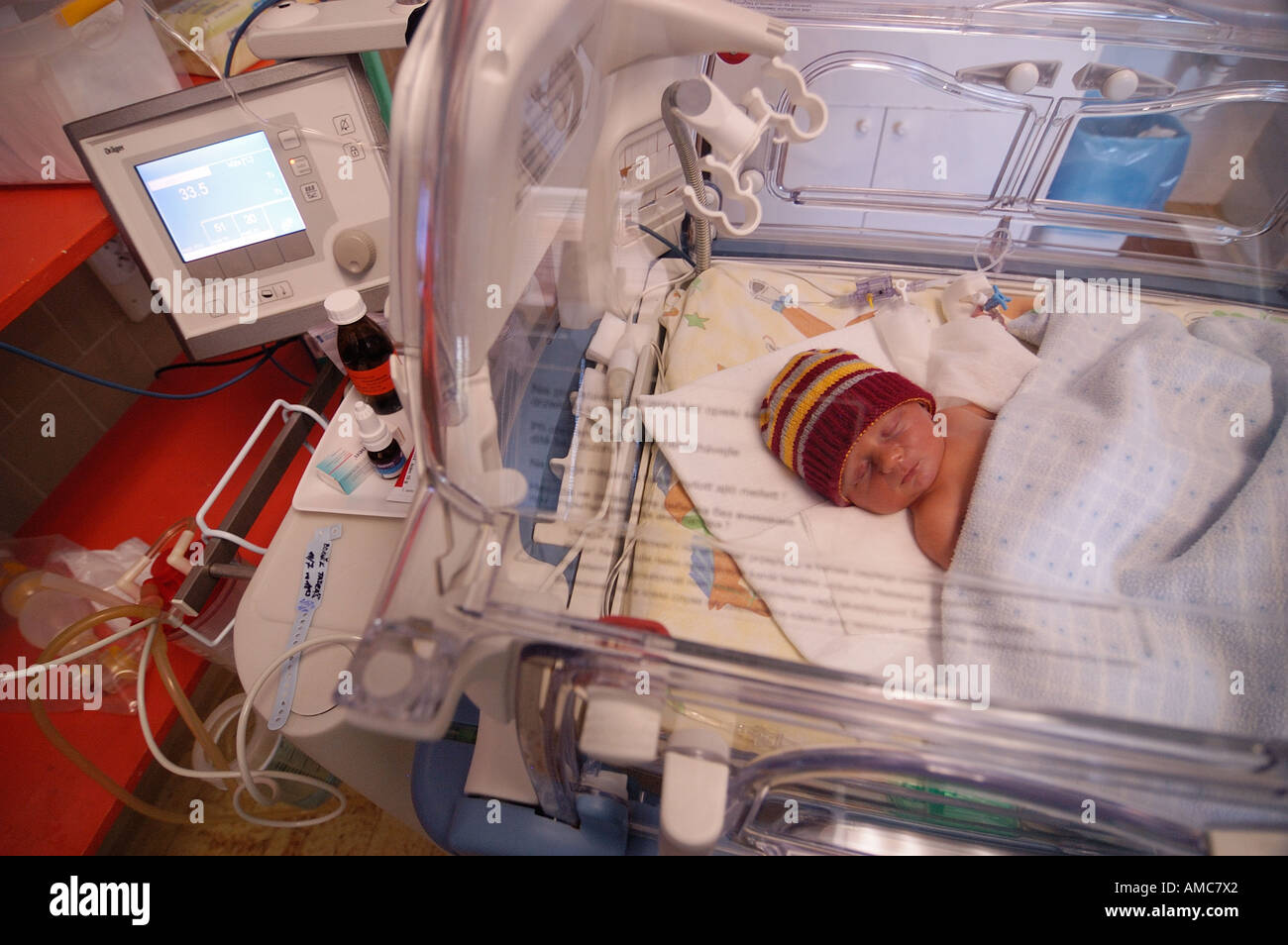 Neonatal Jaundice Stockfotos & Neonatal Jaundice Bilder - Alamy