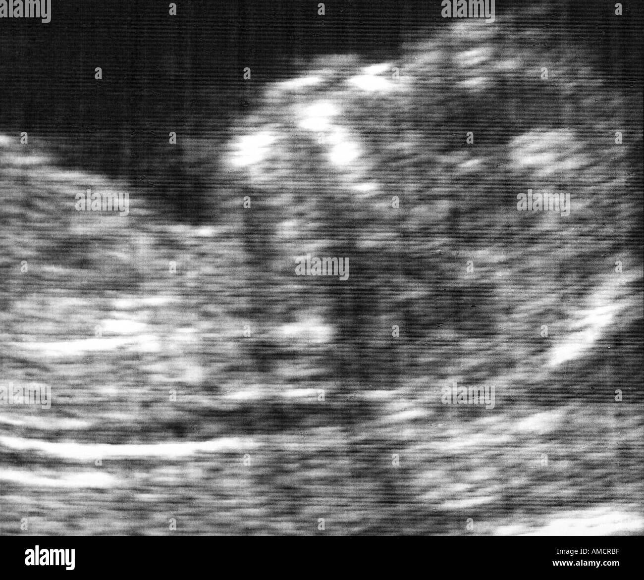In Utero Stockfotos und -bilder Kaufen - Alamy