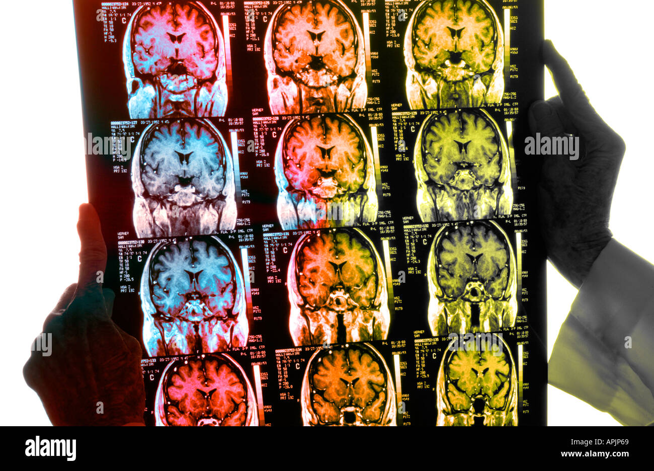 Cerebral cortex -Fotos und -Bildmaterial in hoher Auflösung – Alamy
