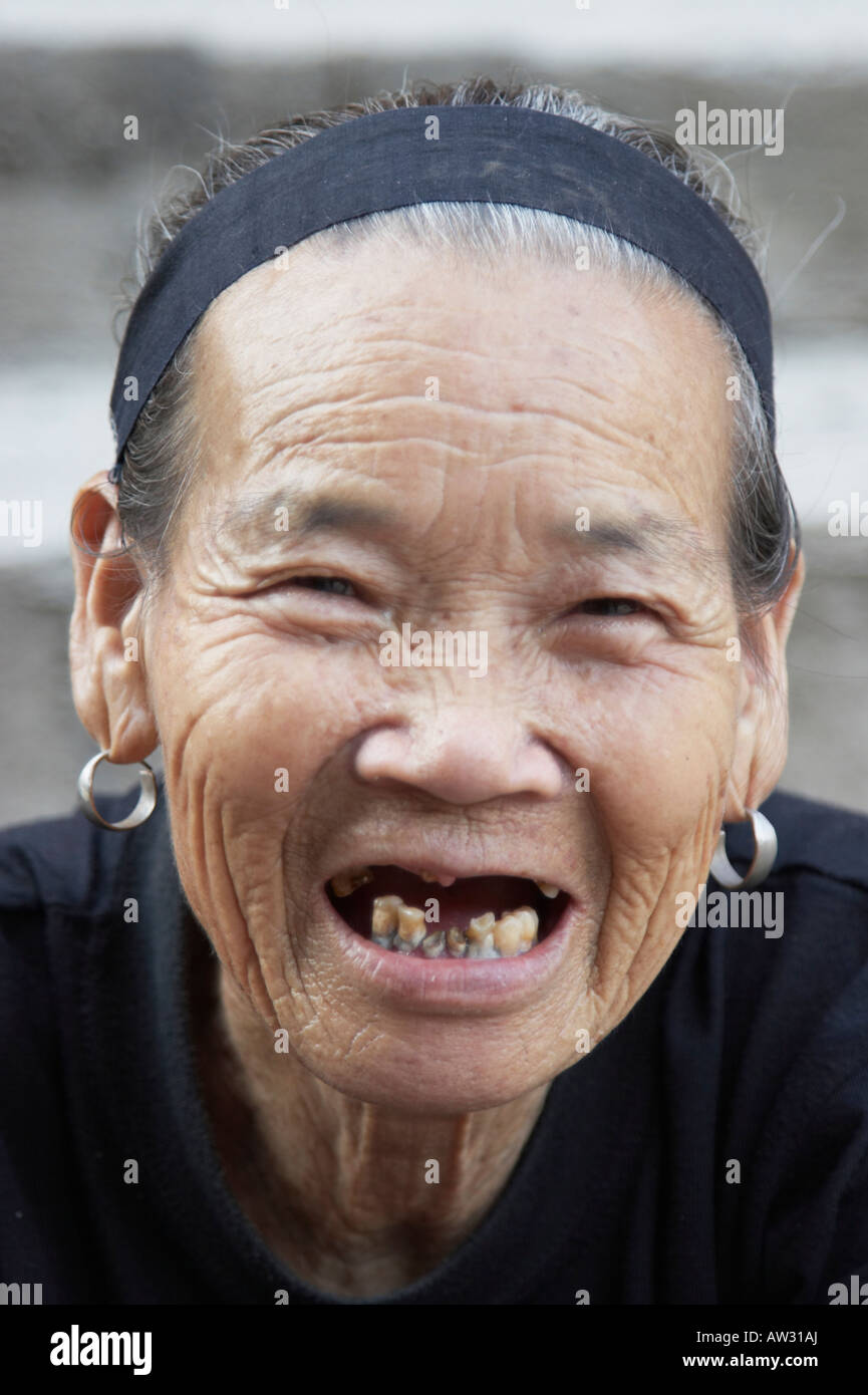 Toothless Lady Stockfotos & Toothless Lady Bilder - Alamy