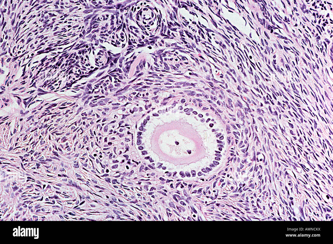 Histology ovary -Fotos und -Bildmaterial in hoher Auflösung – Alamy