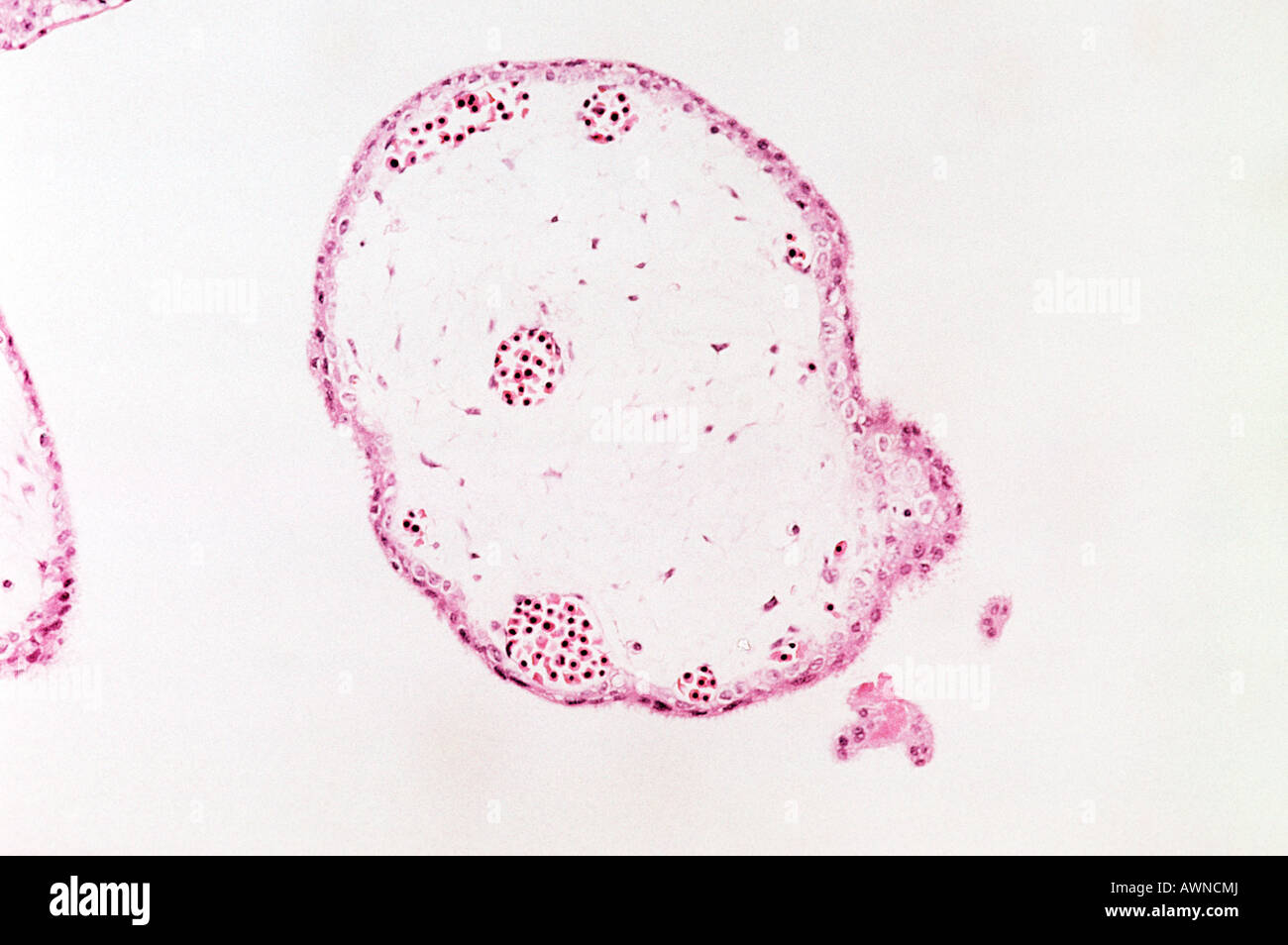 Menschliches chorion -Fotos und -Bildmaterial in hoher Auflösung – Alamy