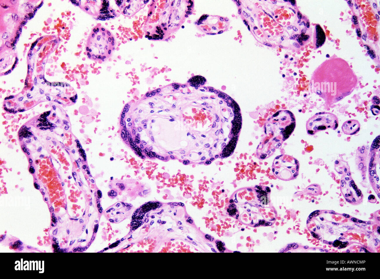 Menschliches Chorion Stockfotos und -bilder Kaufen - Alamy