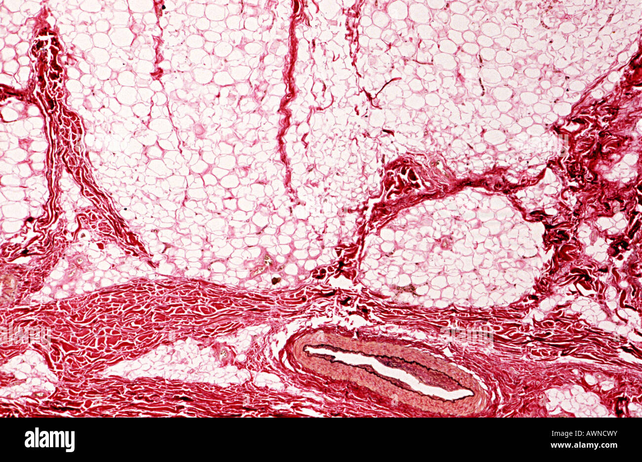 Subcutis of skin -Fotos und -Bildmaterial in hoher Auflösung – Alamy