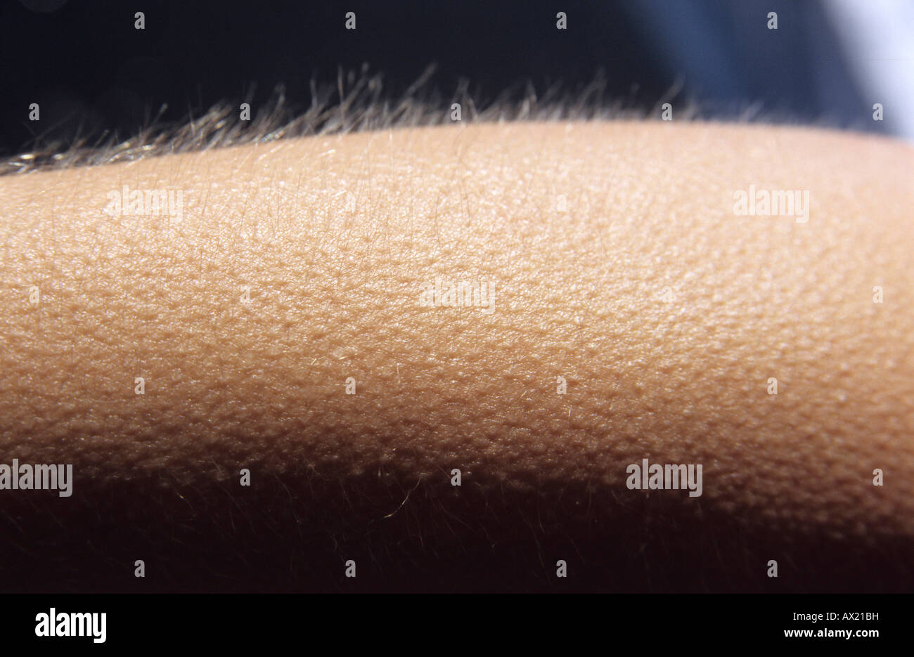 Goose pimples -Fotos und -Bildmaterial in hoher Auflösung – Alamy