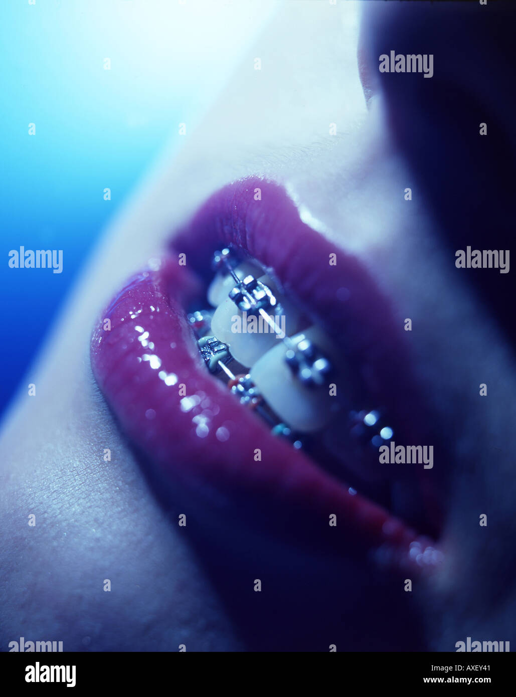 Crooked mouth -Fotos und -Bildmaterial in hoher Auflösung – Alamy