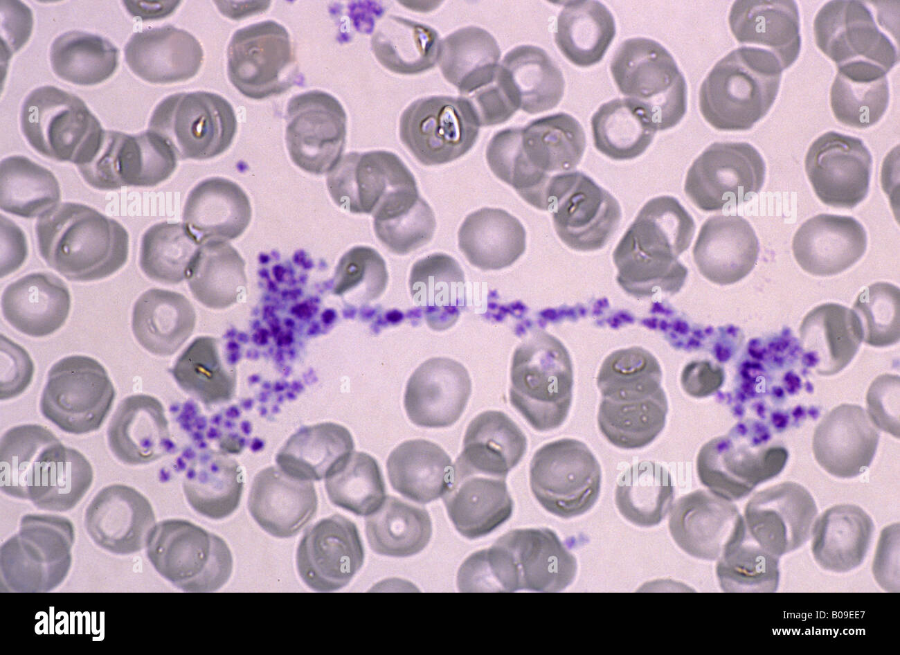 Platelets microscope -Fotos und -Bildmaterial in hoher Auflösung – Alamy