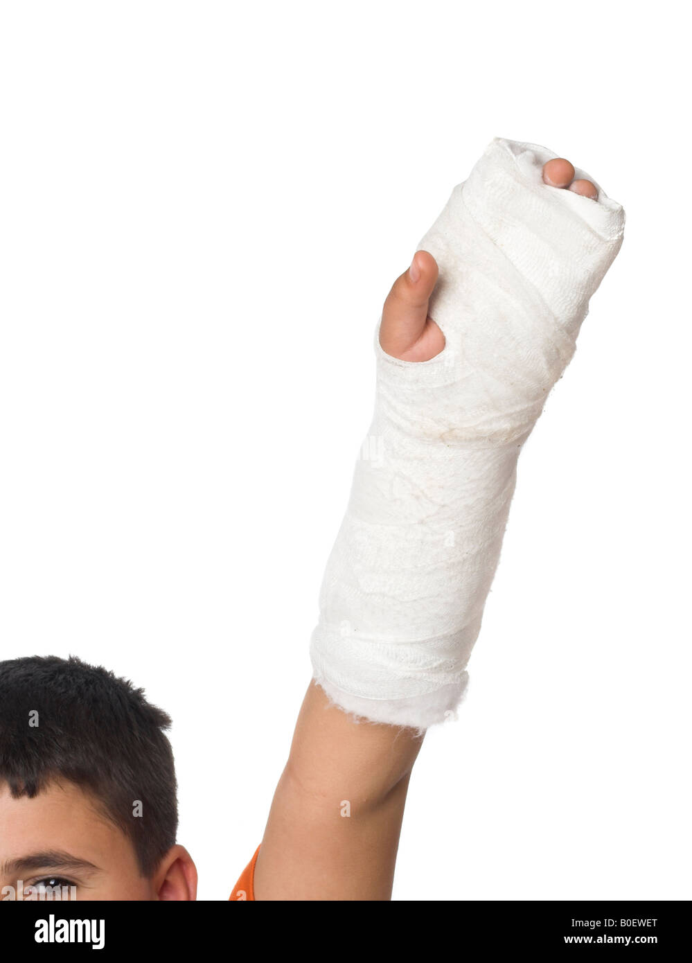 Knochen gebrochen isoliert -Fotos und -Bildmaterial in hoher Auflösung ...