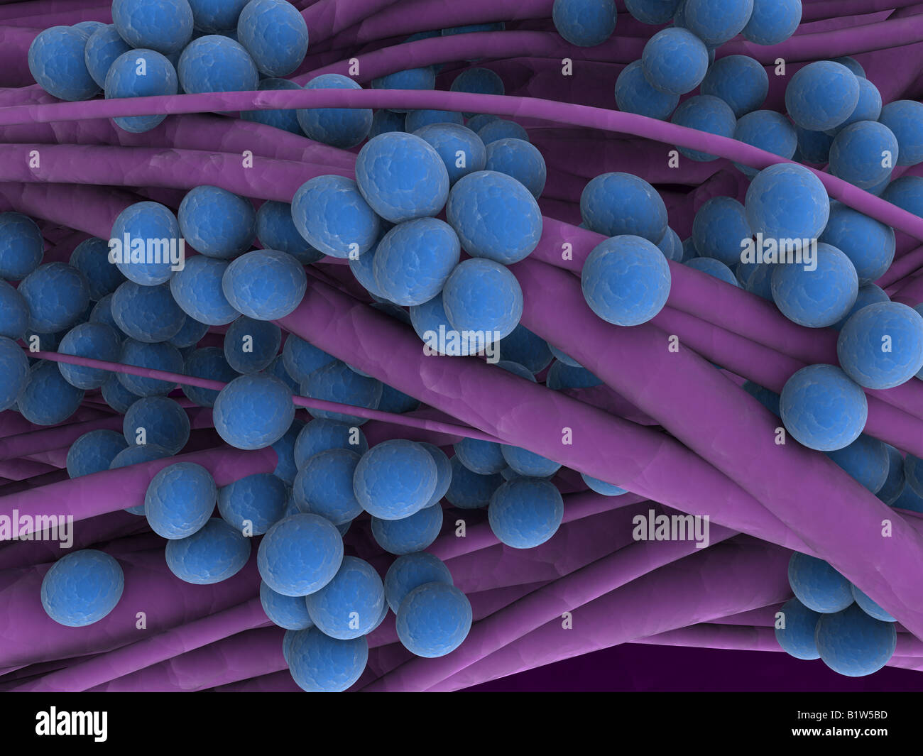 Staphylococcus Infektion Stockfotos und -bilder Kaufen - Alamy