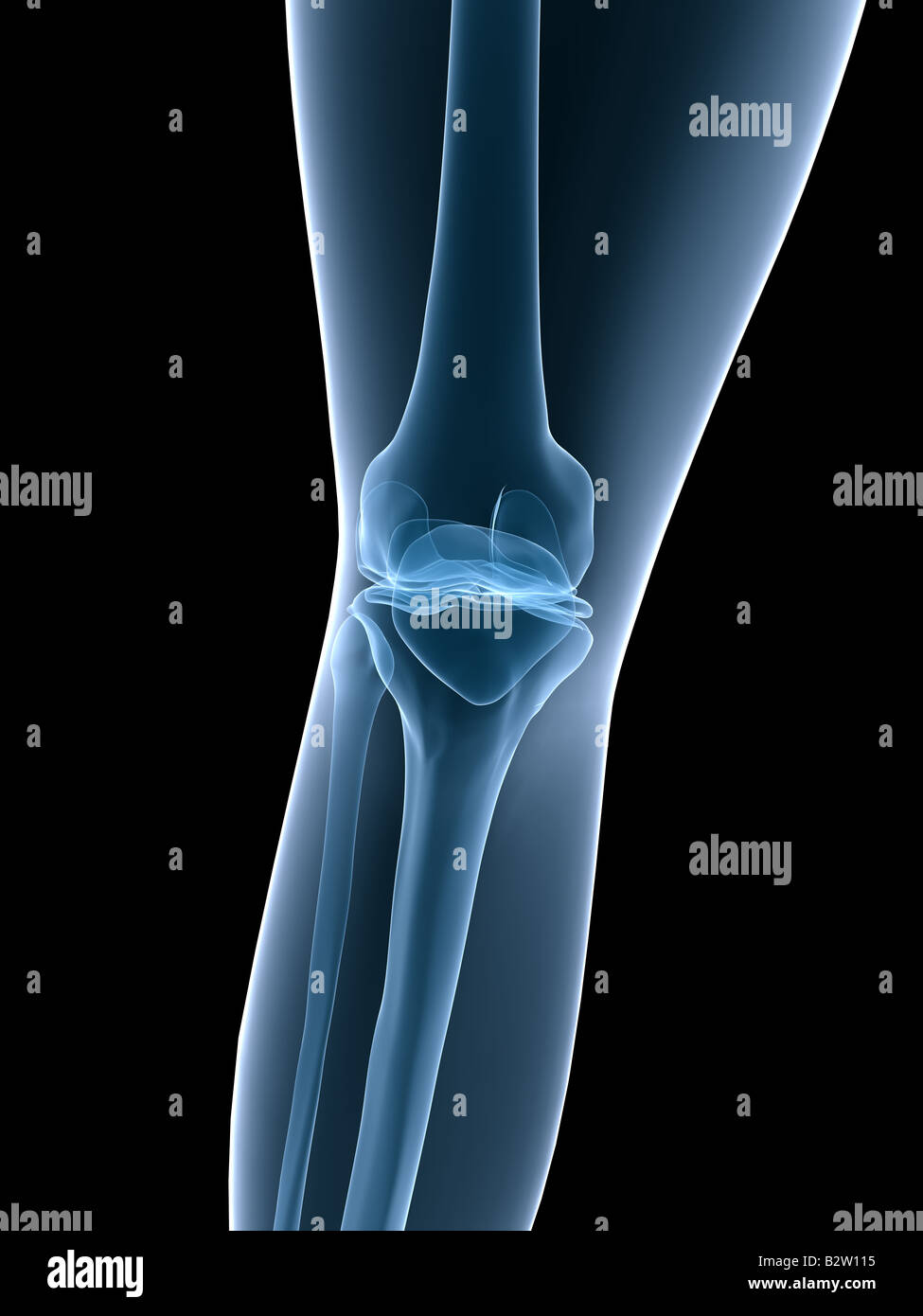 Knie röntgen -Fotos und -Bildmaterial in hoher Auflösung – Alamy