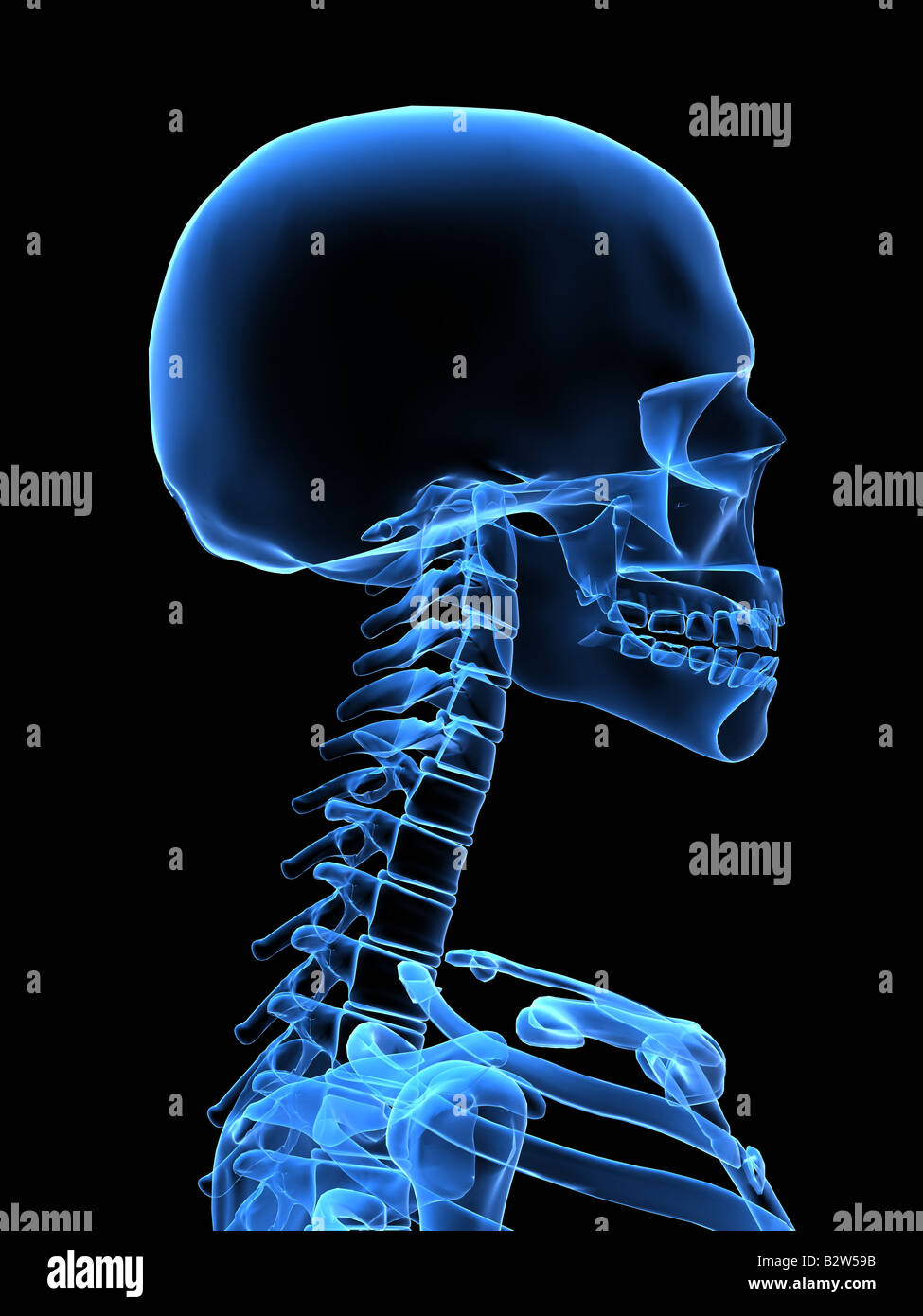 Kopf röntgen -Fotos und -Bildmaterial in hoher Auflösung – Alamy
