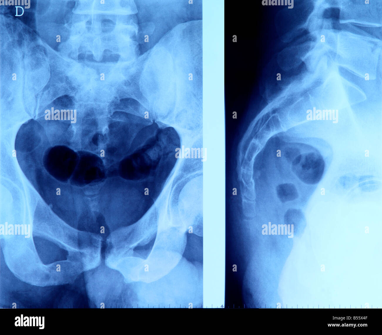 Becken Stockfotos & Becken Bilder - Alamy